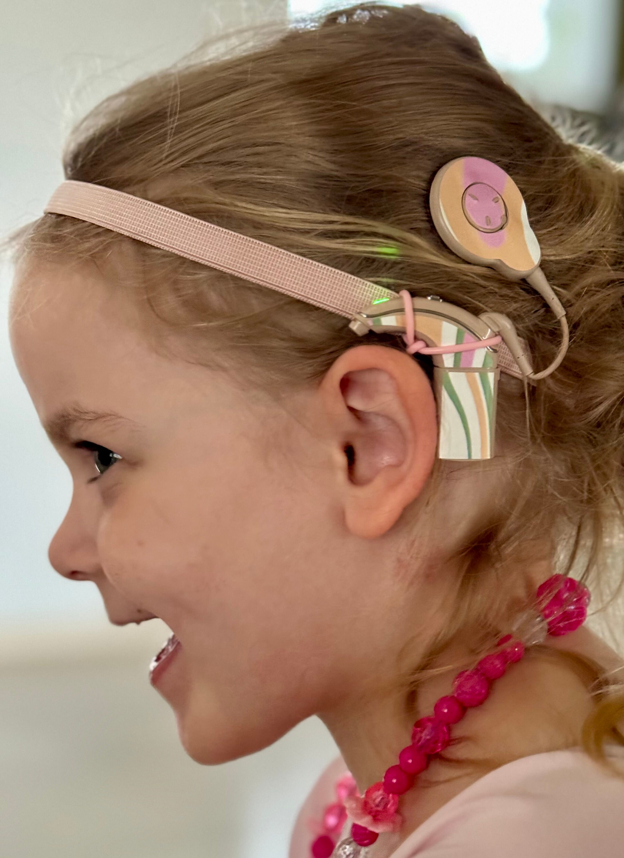 Stickers (waves) for Cochlear Implant Nucleus 7 - Etsy