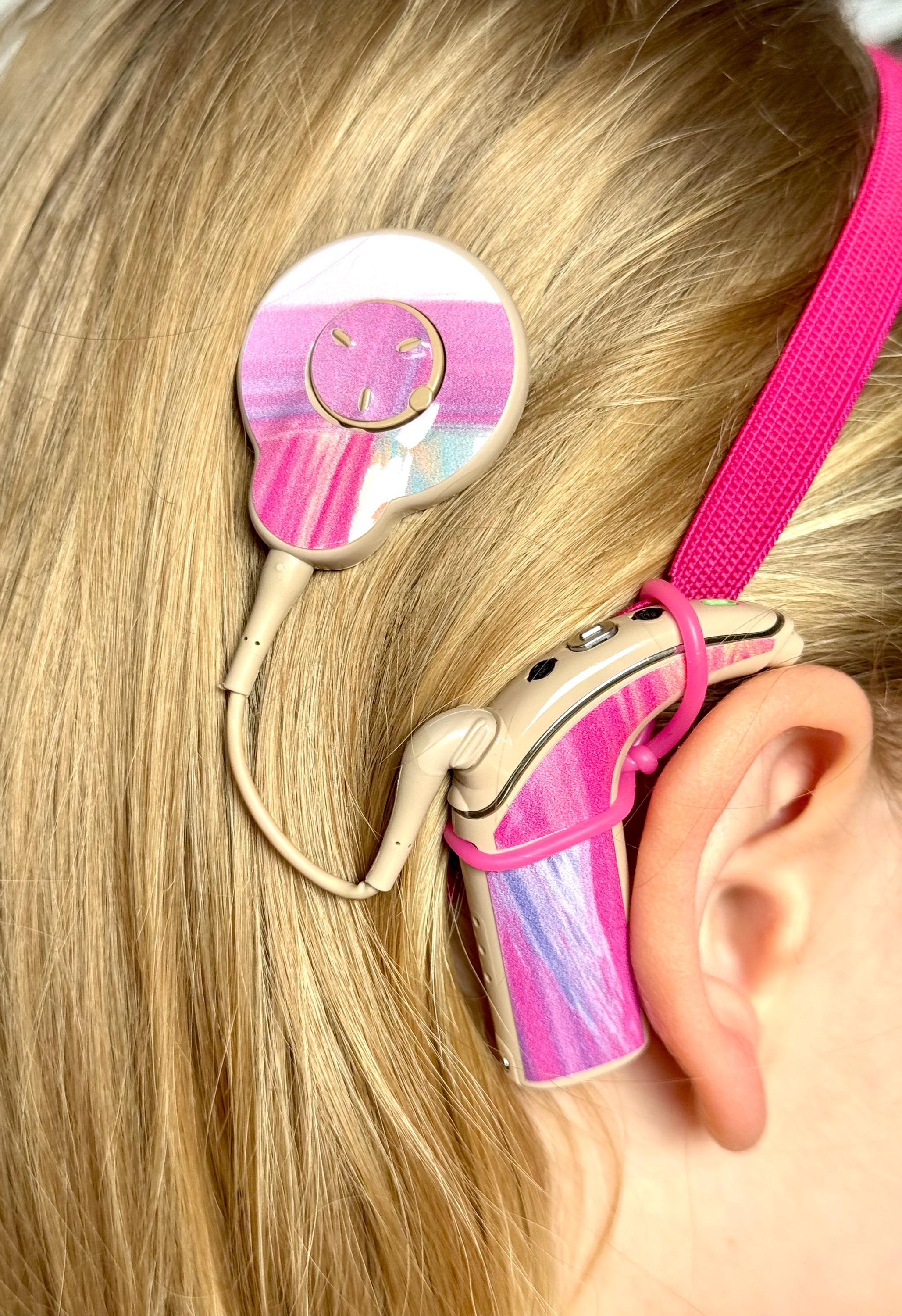 Stickers for Cochlear Implant Nucleus 7-personalize and Protect Your Device - Etsy