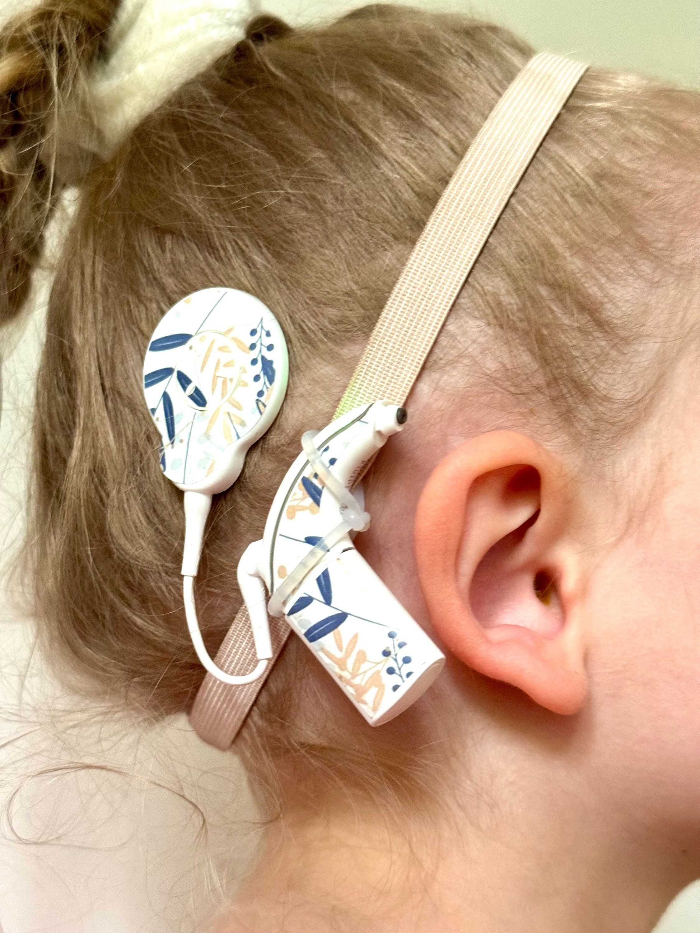 Stickers (leaves) for Cochlear Implant Nucleus 7 - Etsy