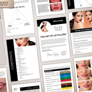 Lip Filler Training Manual, Augmentation Guide, Editable Ebook (PDF) - Etsy