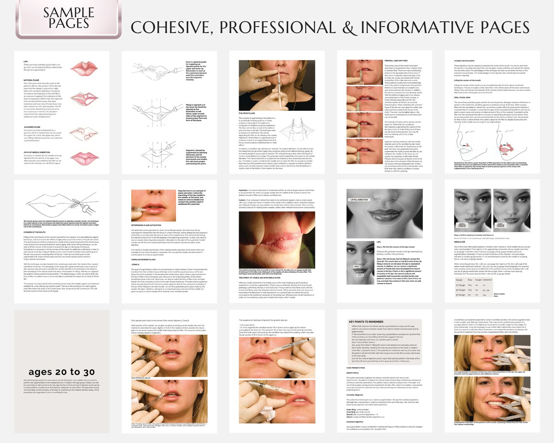 Lip Filler Training Manual, Injection Techniques, Botox (editable Canva ...
