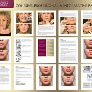 Lip Filler & Botox Training Manual, Lip Augmentation Guide (ebook ...