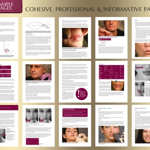 Lip Filler & Botox Training Manual, Lip Augmentation Guide (ebook ...