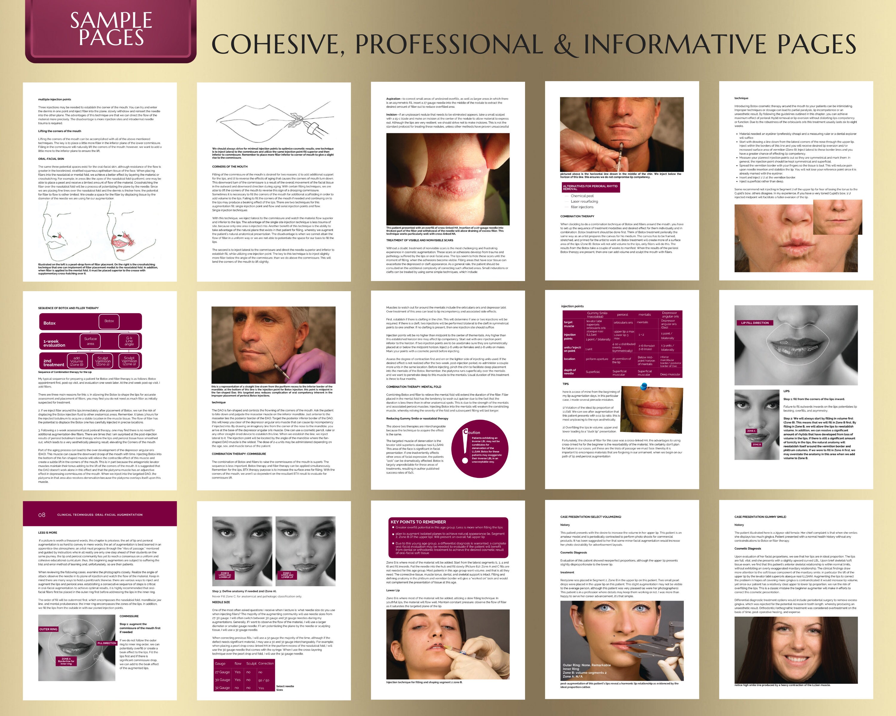 Lip Filler Manual, Peri Oral Filler & Botox Training Manual, Lip ...