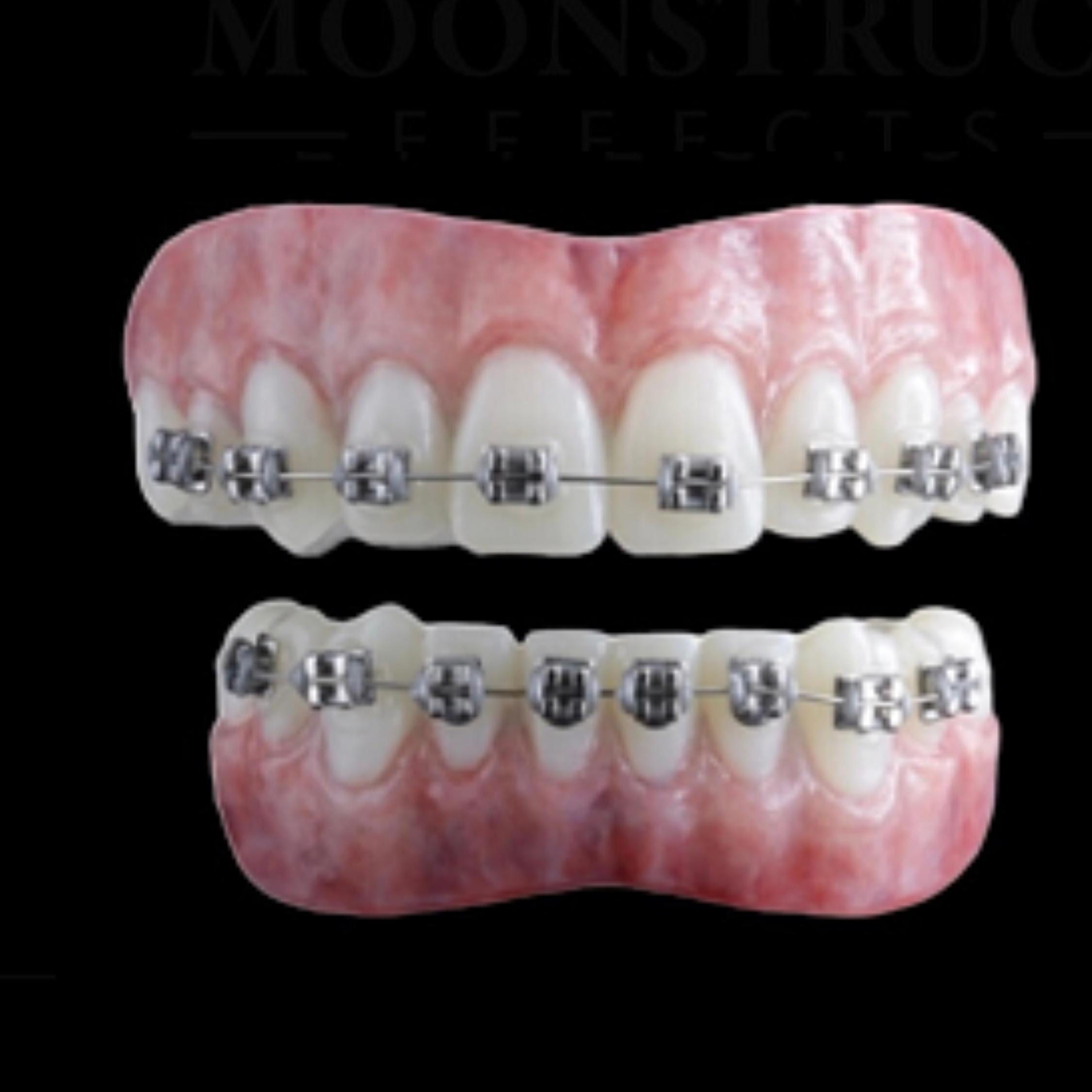 Silver Braces , Ugly Betty Teeth , Nerd Fake Teeth With Braces , Geek ...