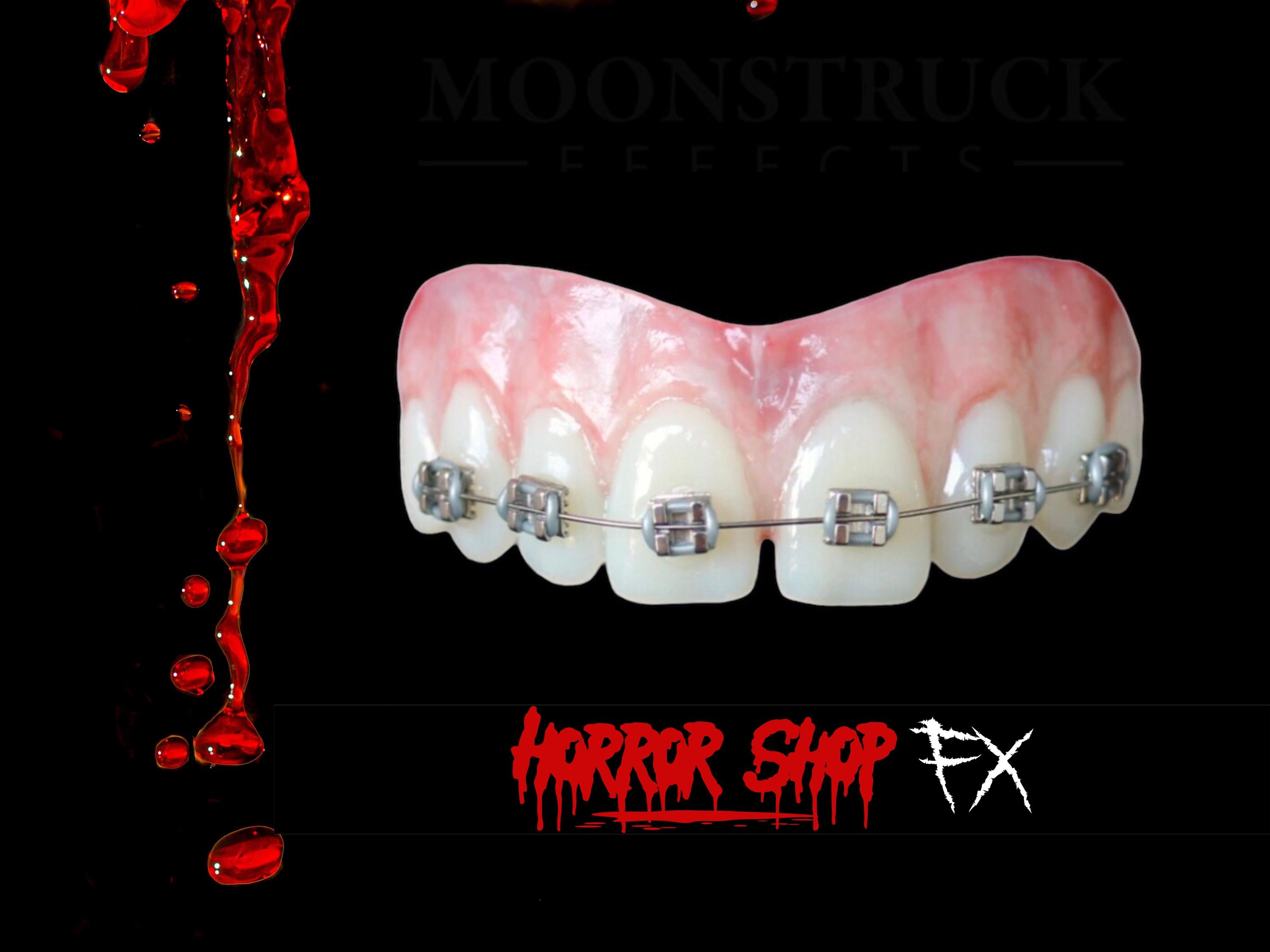 Silver Braces , Ugly Betty Teeth , Nerd Fake Teeth With Braces , Geek ...