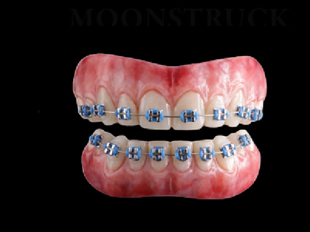 Blue Braces , Ugly Betty Teeth , Nerd Fake Teeth With Braces , Fake ...