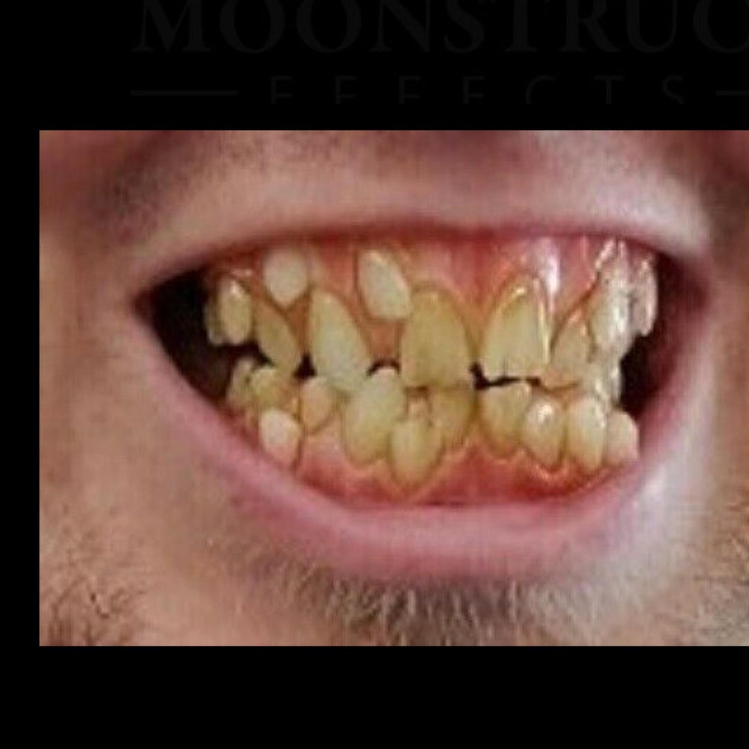 Realistic Zombie Teeth Veneers: Crooked Stained Horror FX Teeth - Etsy