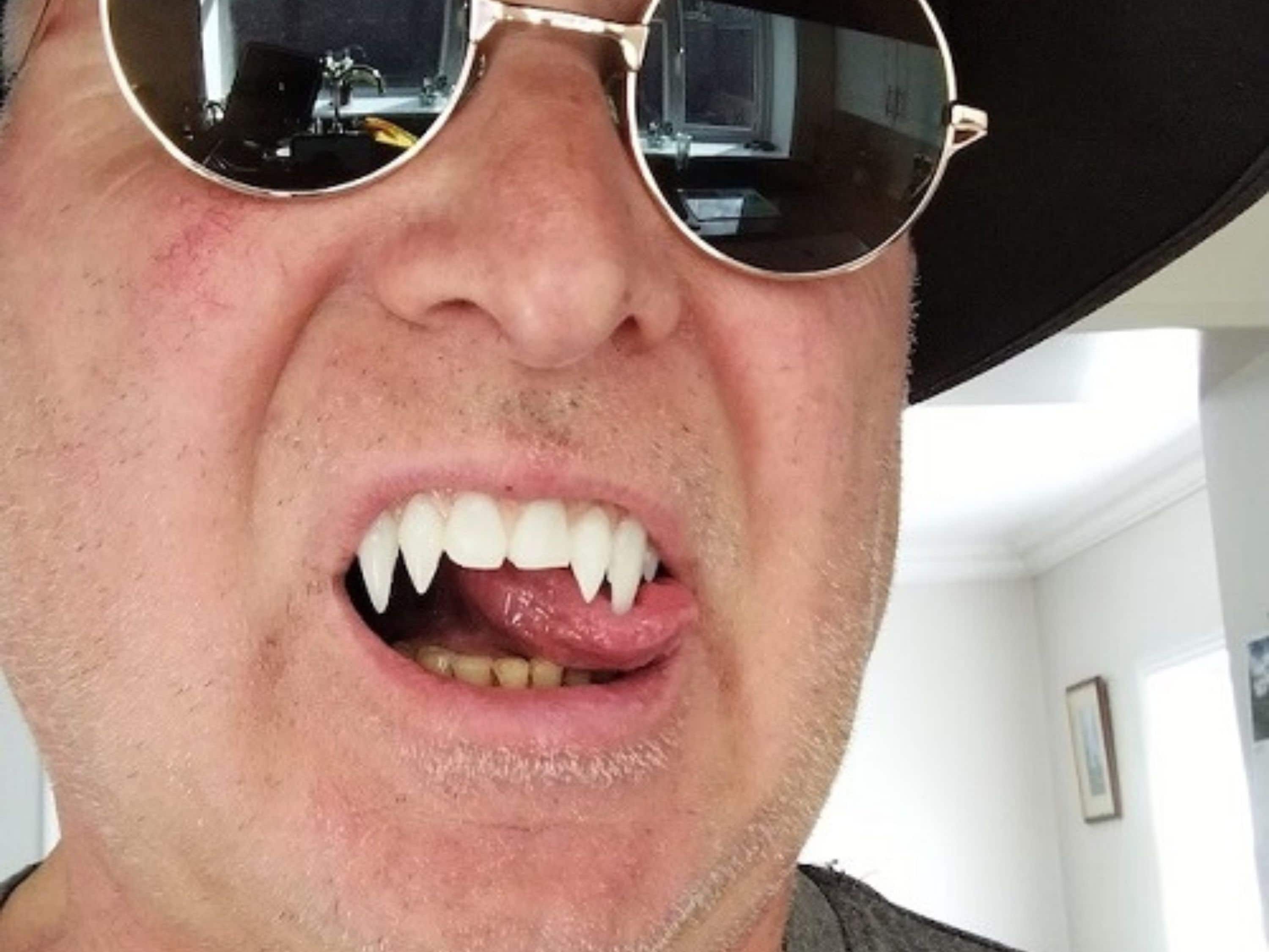 Realistic Vampire Fangs , Vampire Teeth , Custom Fit Vampire Fangs ...