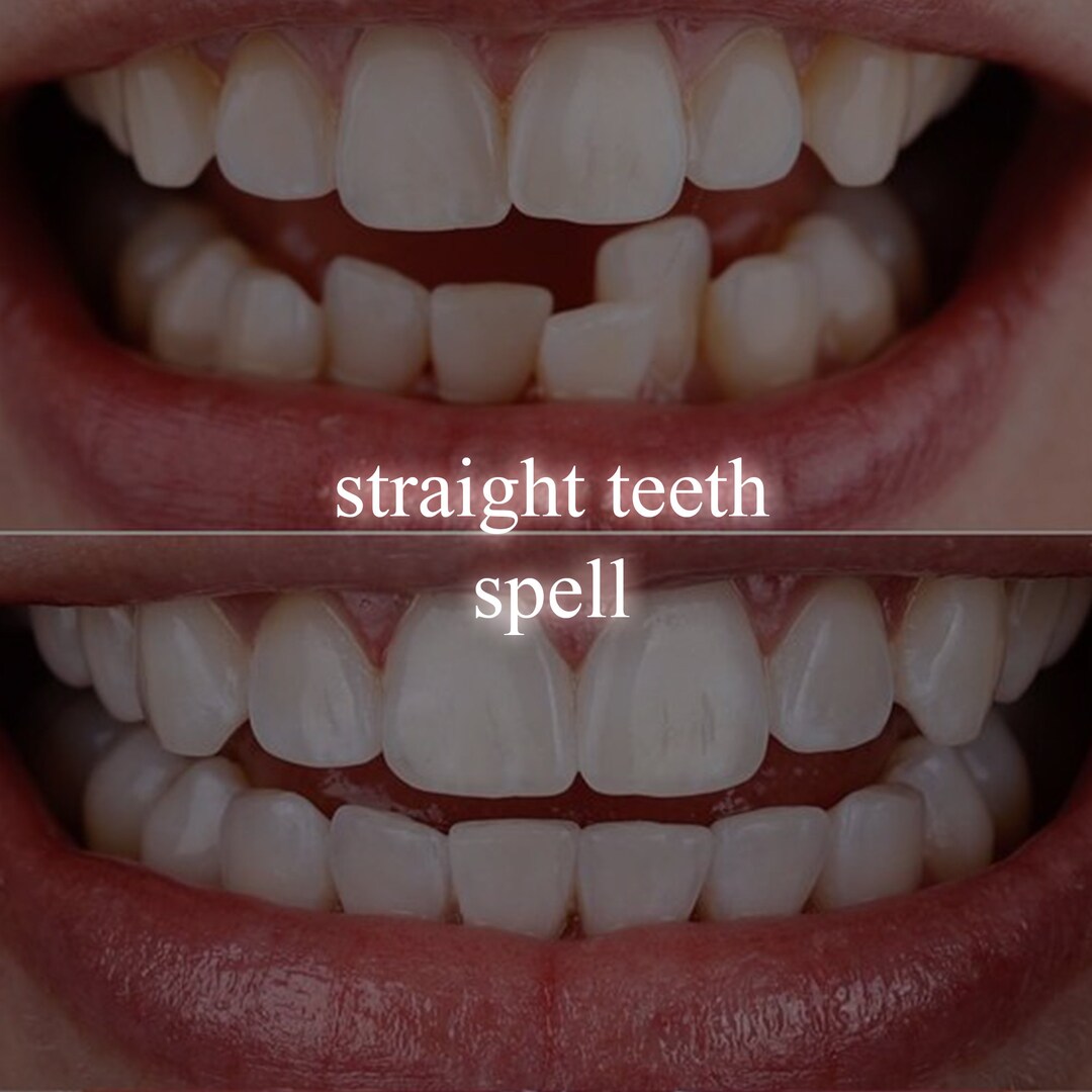 STRAIGHT TEETH SPELL same Day Straight Teeth Spell, No Braces ...