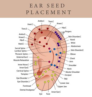 Printable Ear Seed Placement Chart Comprehensive Acupuncture Ear Chart ...