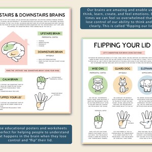 Flipping Your Lid, Emotional Regulation, Hand Model of the Brain ...