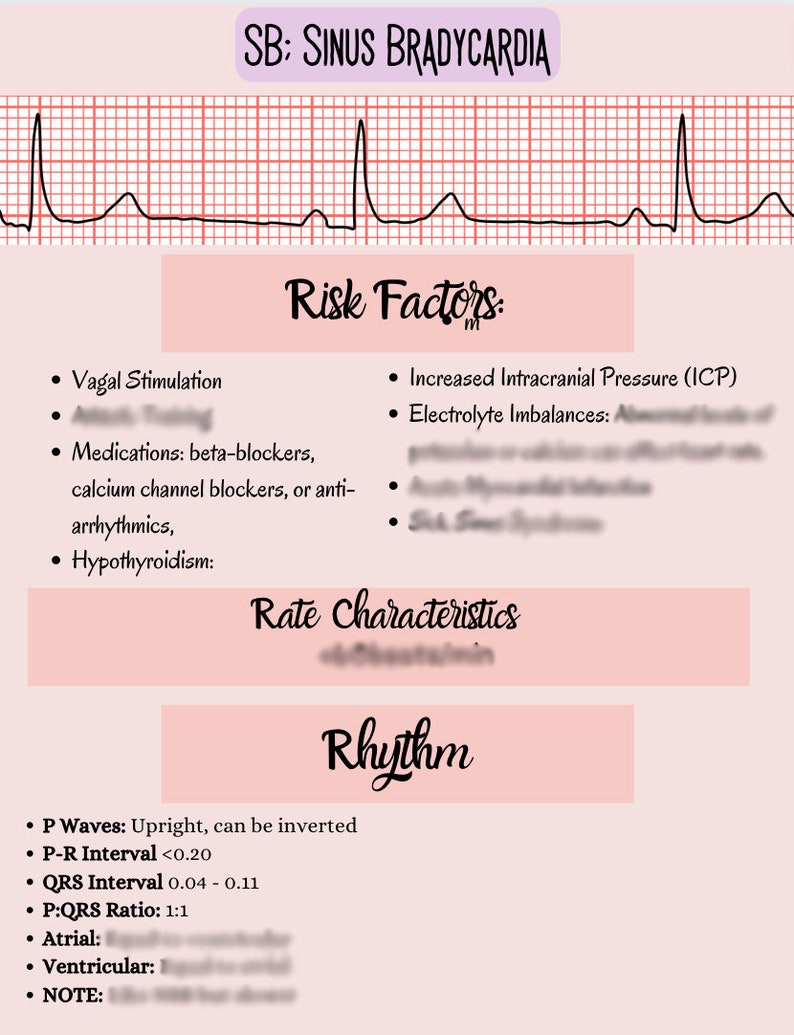 EKG Dysrhythmia Study Guide: Nurse Cardiac Notes (PDF) - Etsy
