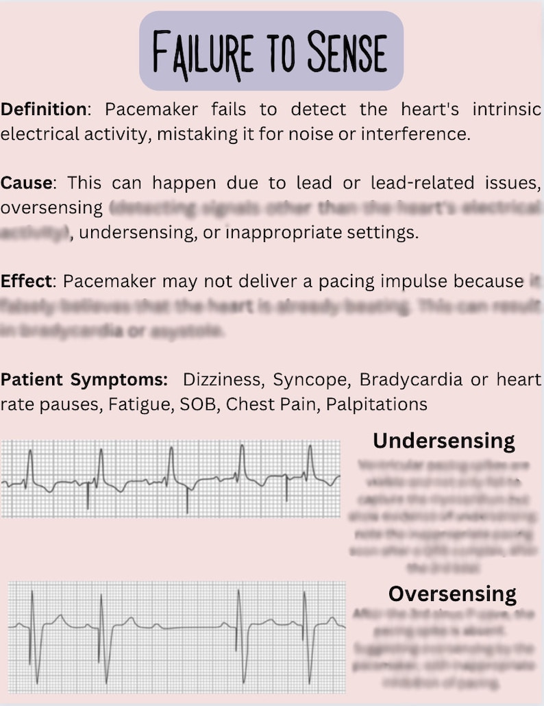 EKG & Dysrhythmia Interpretation Basics for Nurses + Nursing Students ...