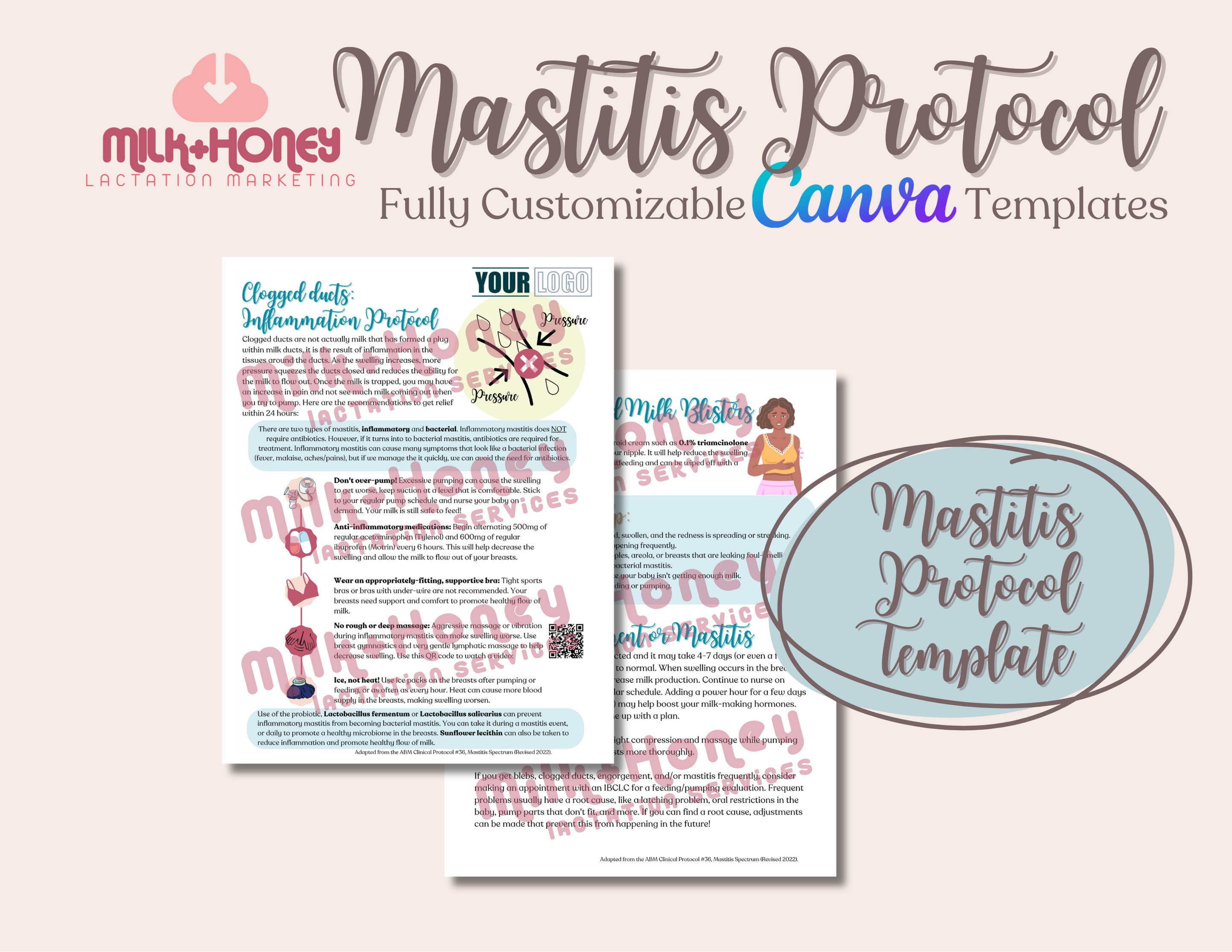 Clogged Ducts and Mastitis Protocol Template - Etsy