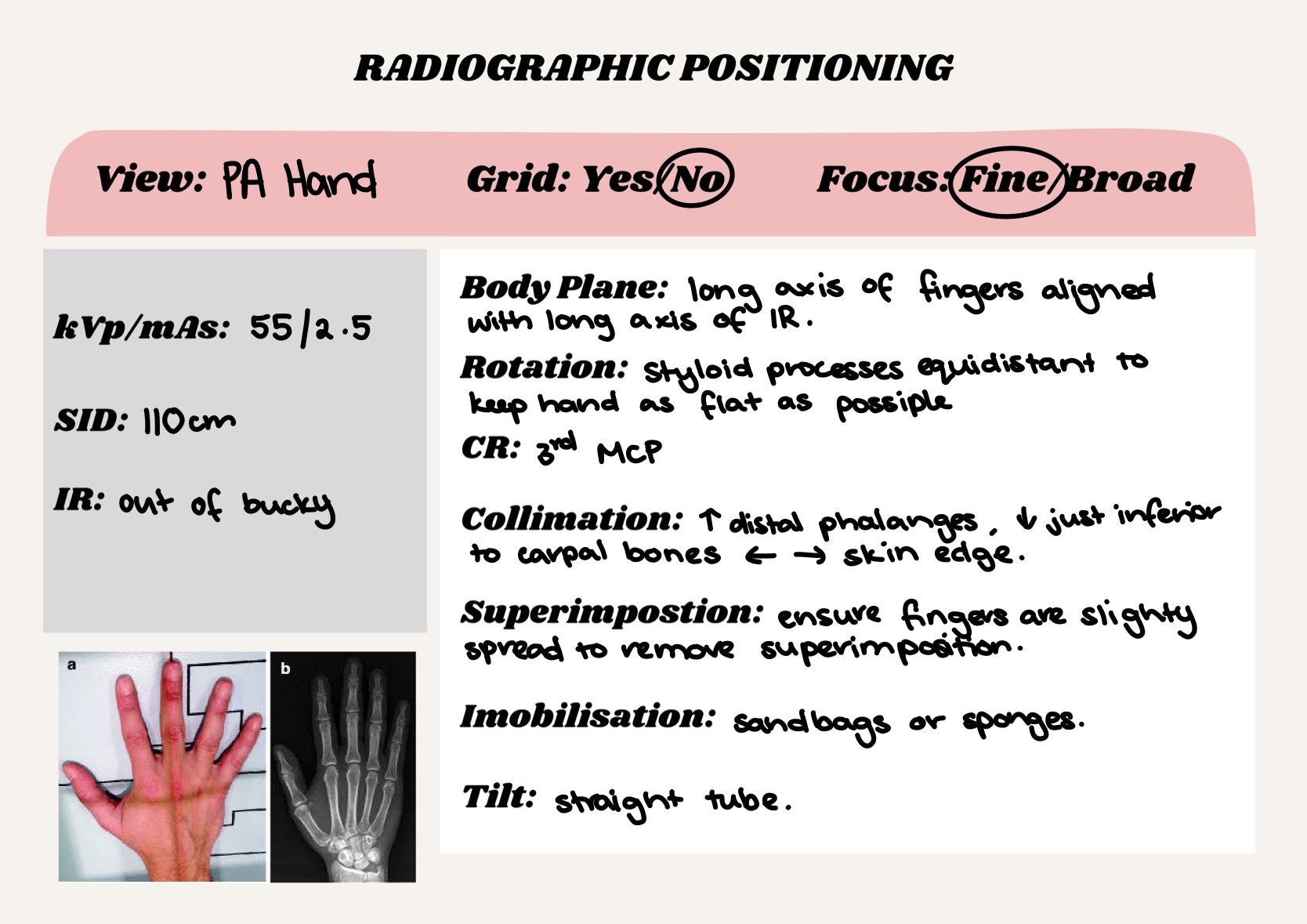 Radiography radtech A5 Positioning Flash Cards DIGITAL DOWNLOAD - Etsy