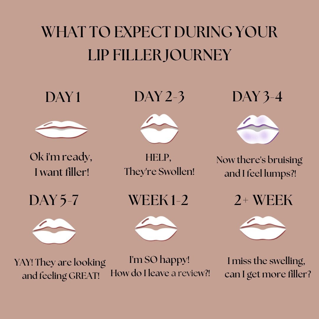 Lip Filler Journey Card - Etsy