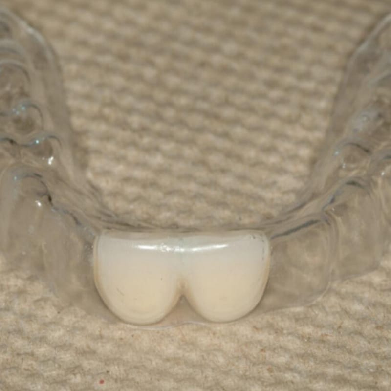 Fake Teeth Gift - 60+ Gift Ideas for 2026