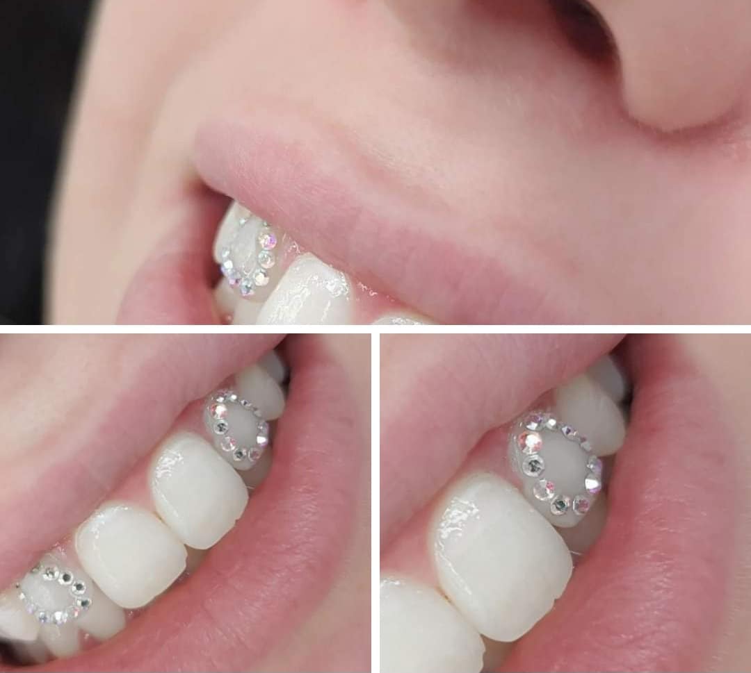 Great Fitting Retainer With Diamonds Customization or Logo.1 Top or ...