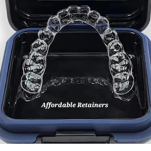 Retainers Customize for a Perfect Fit 1 Save Lots of Money and Office ...