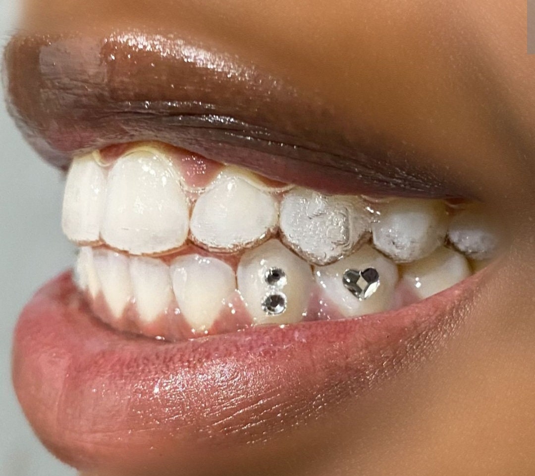 Great Fitting Retainer With Diamonds Customization or Logo.1 Top or ...