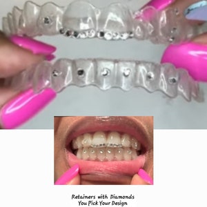 Great Fitting Retainer With Diamonds Customization or Logo.1 Top or ...