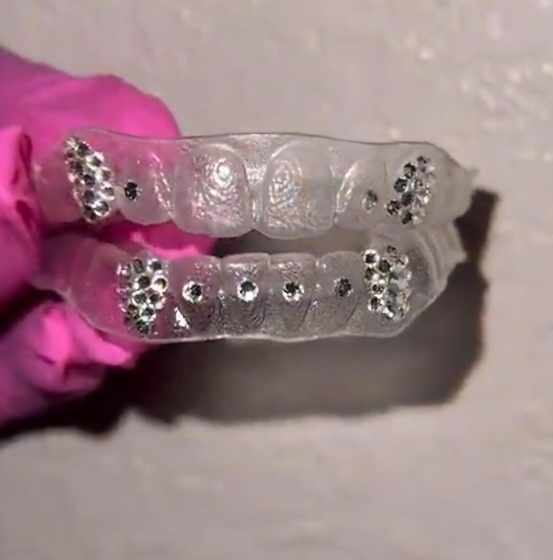 Get a Great Fiting Custom Retainer With Added Diamonds. You Choose Your ...