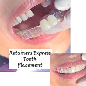 Cheap retainers store