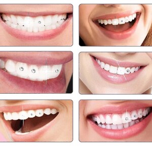 Great Fitting Retainer With Diamonds Customization or Logo.1 Top or ...