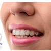 Dental Putty and Upper and Lower Trays for Impressions/putty for Night ...