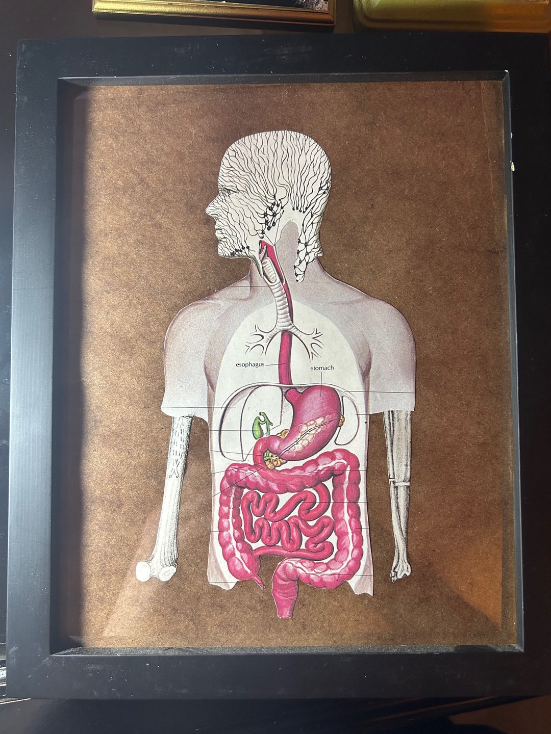 Medical Collage Collage Art Outsider Art - Etsy