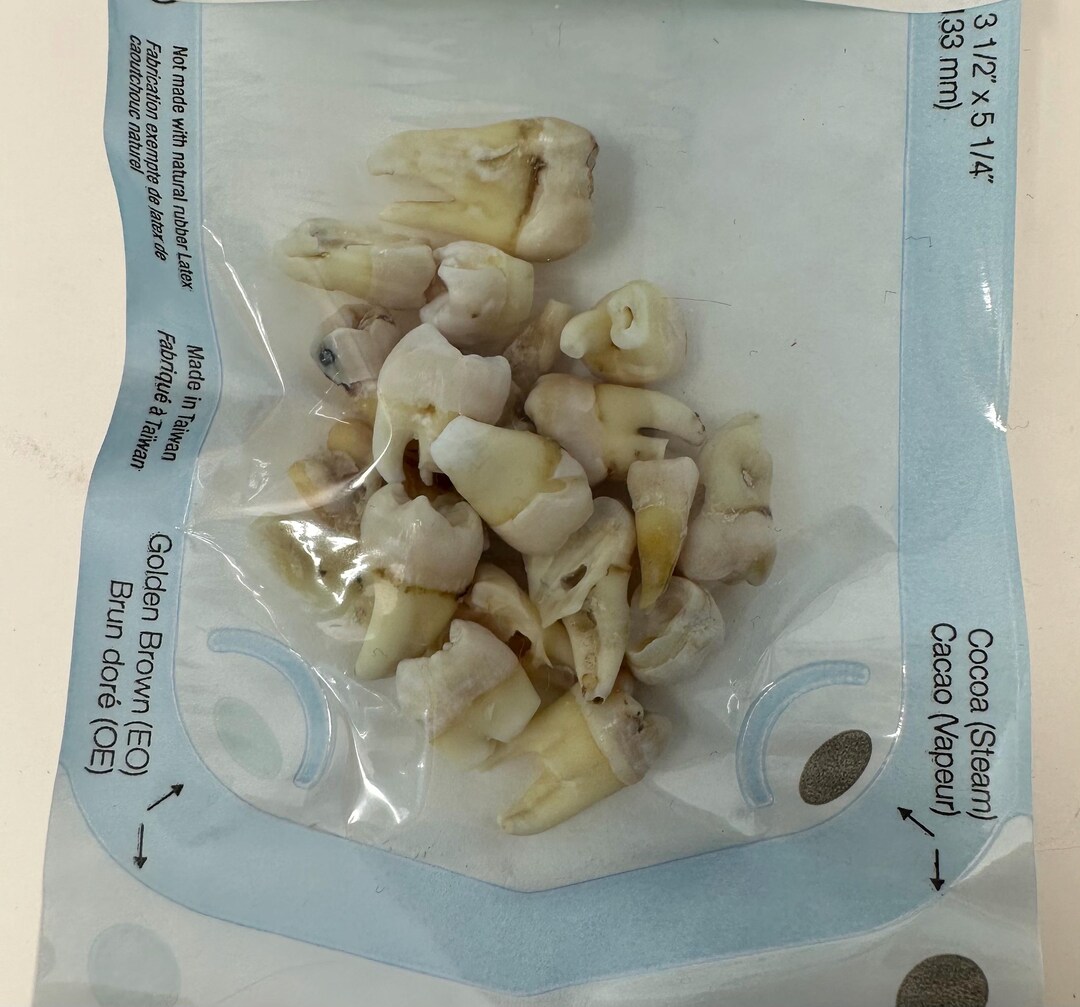 100% REAL Human Teeth, STERILIZED, for Jewelry, for Dental Students ...