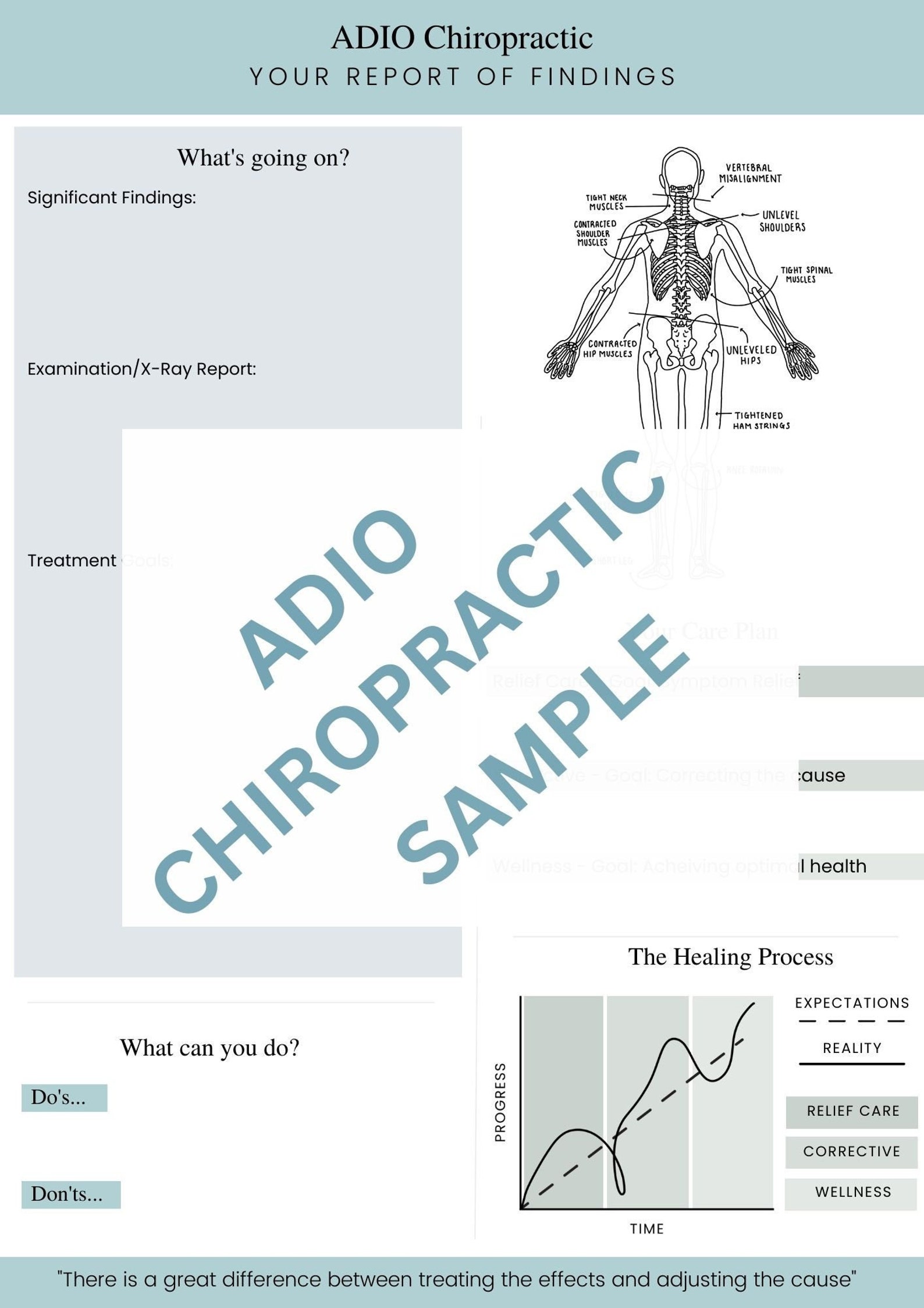 Report of Findings Handout Template //printable // Chiropractic ...