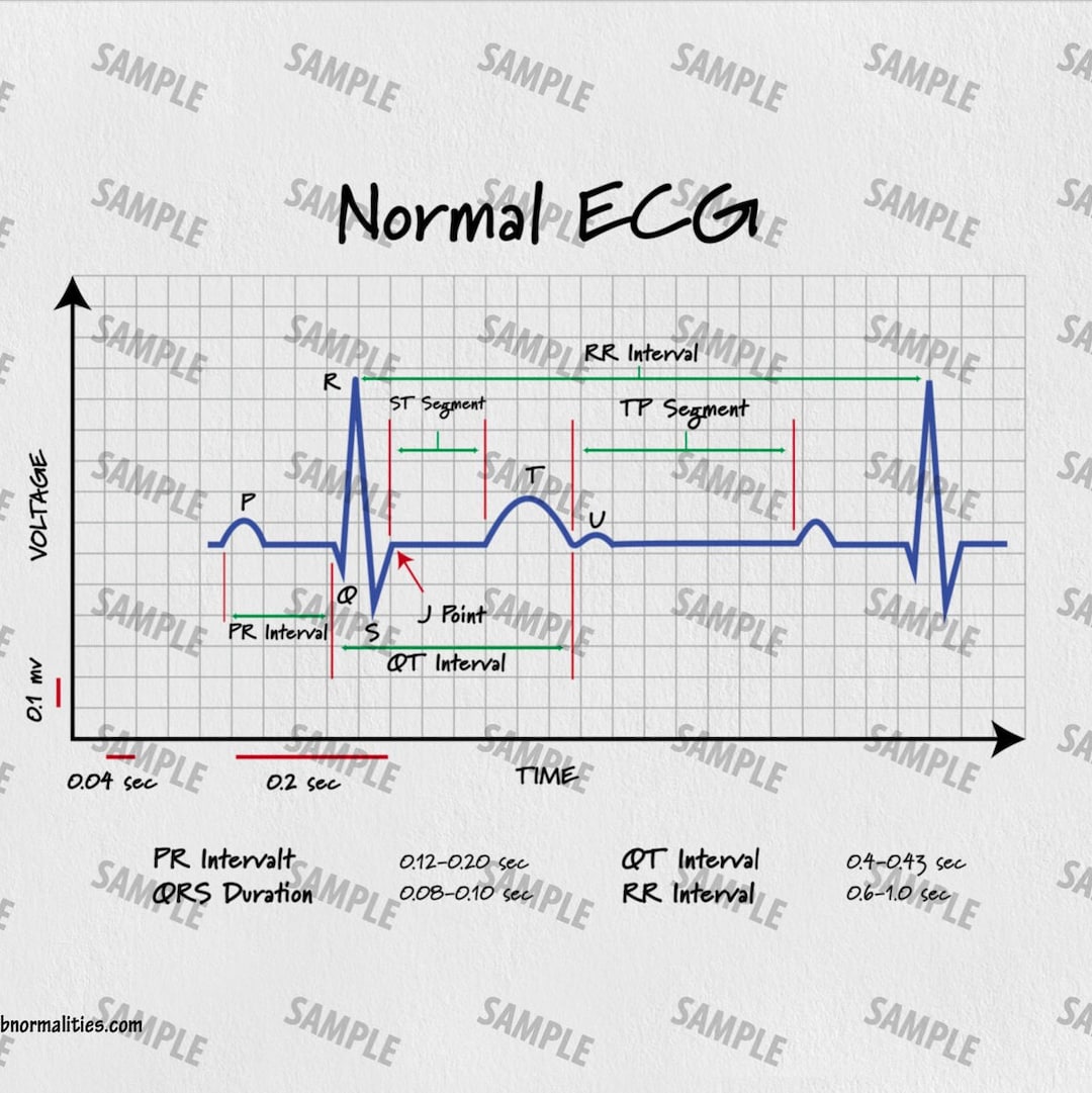 EKG Basics Digital Download, Letter Sized - Etsy