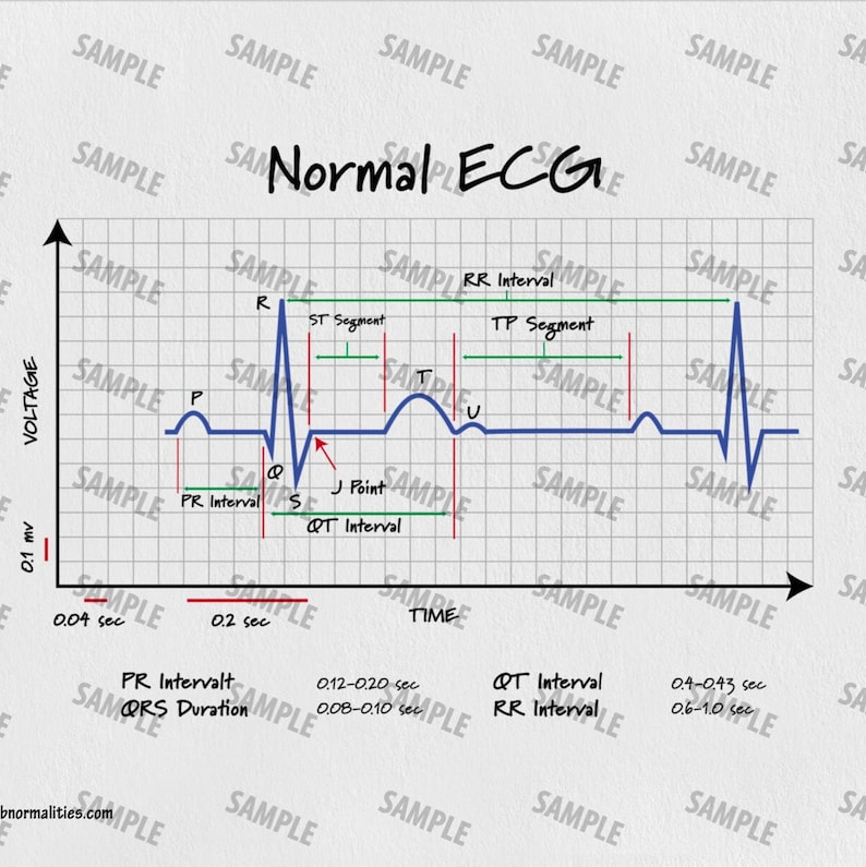 EKG Basics Digital Download, Letter Sized - Etsy