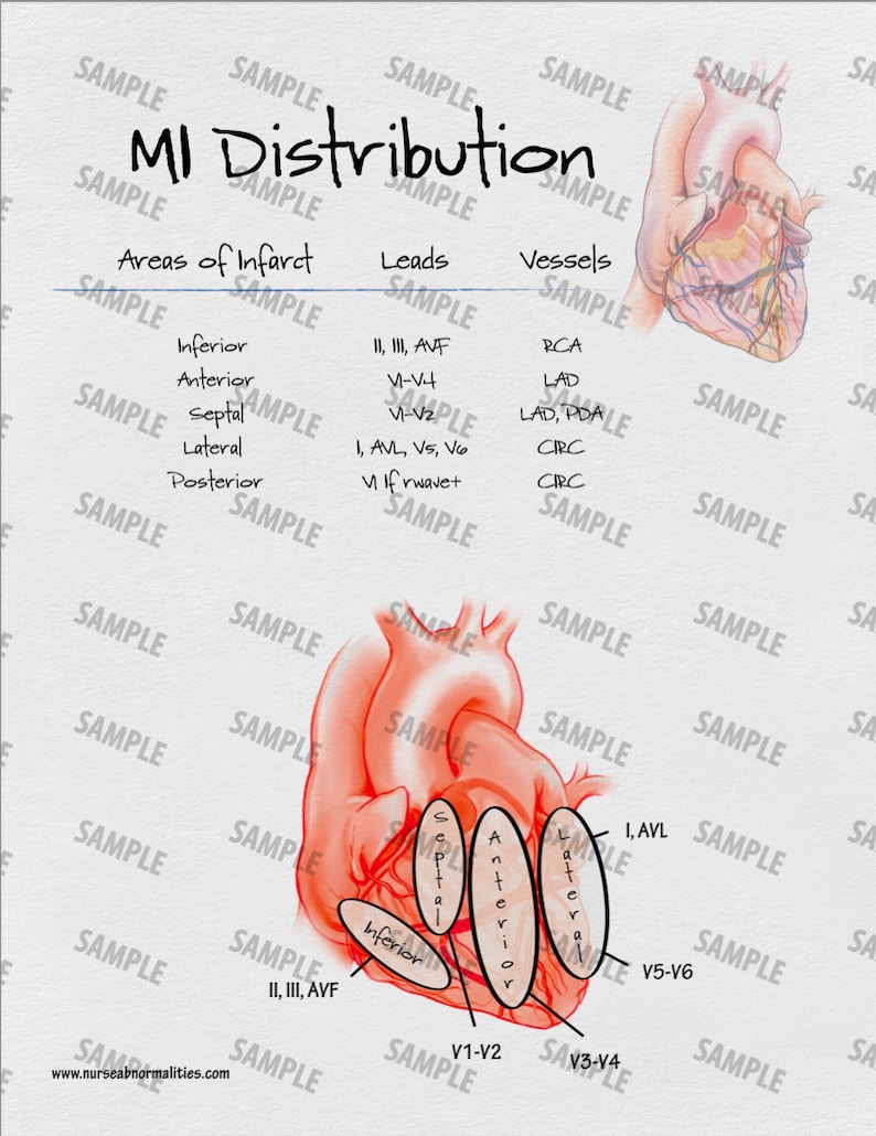 Bundle - Cardiac Nurse Total Bundle (6 Documents) - Etsy