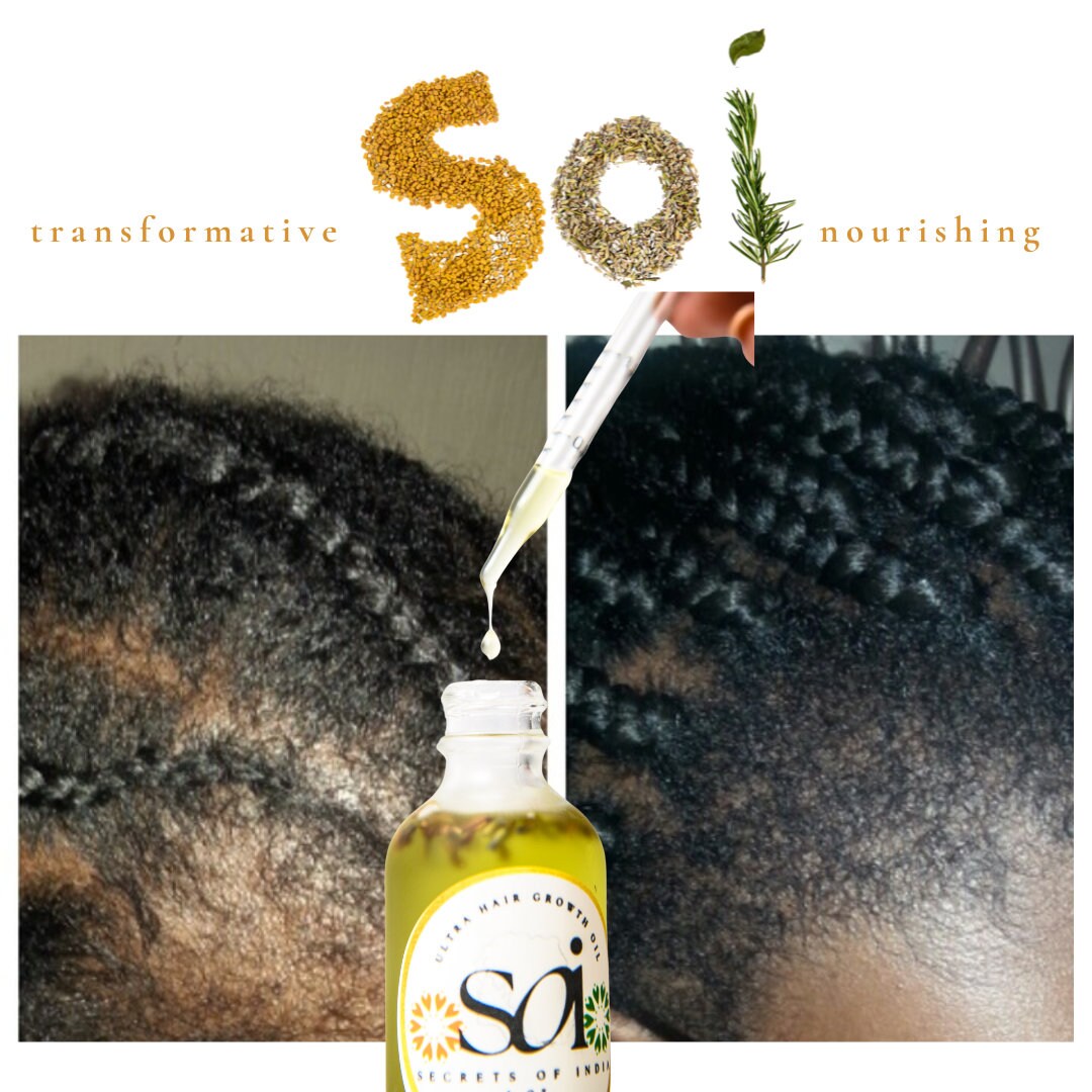 INDIAN AYURVEDIC Herbal Hair Growth Oil Thickens & Strengthens Helps ...