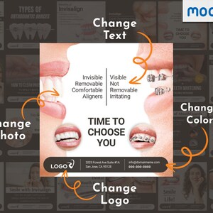 Canva Dental Invisalign Templates Bundle | Invisalign Templates Social ...