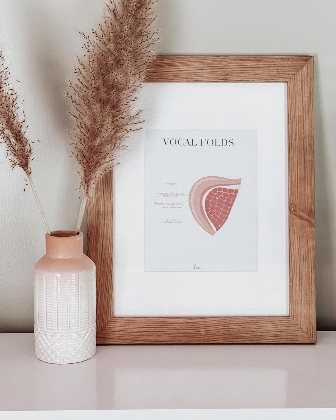 A4/A5 Poster Layers of Vocal Folds I DIGITAL for Voice Professionals - Etsy