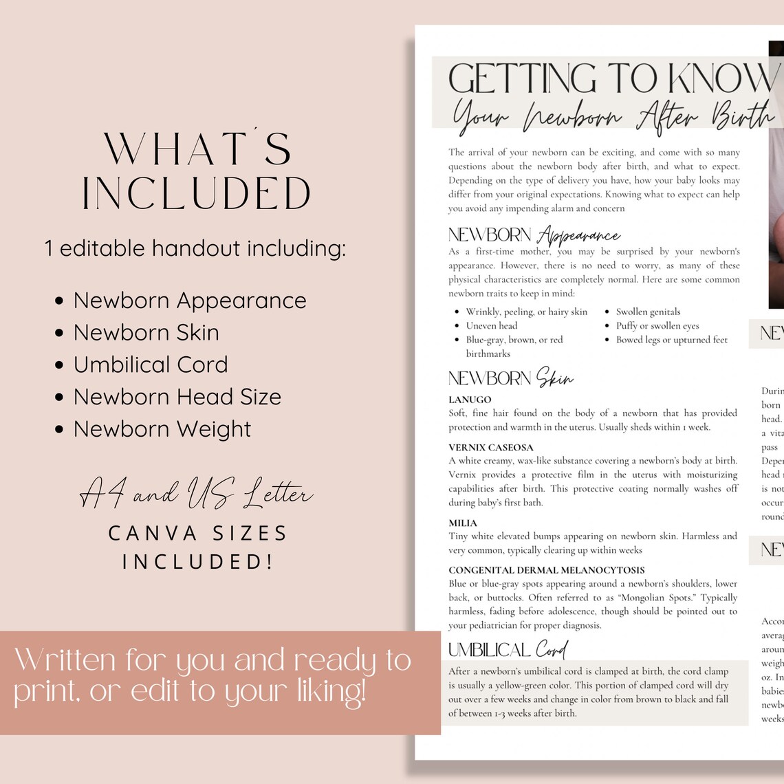 Getting to Know Your Newborn After Birth Handout, Newborn Appearance ...