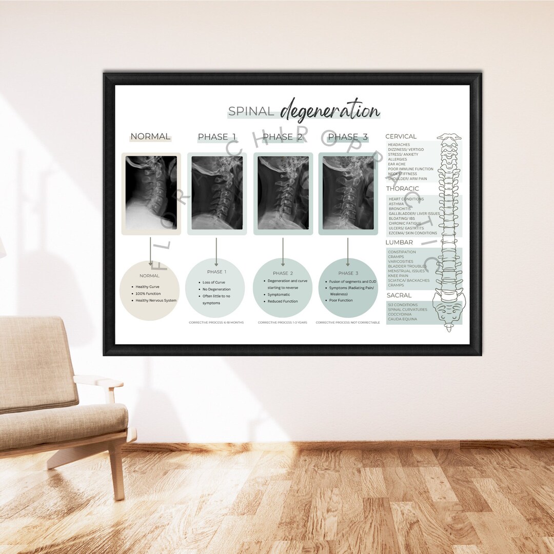 Spinal Degeneration Poster Pdf Download - Etsy
