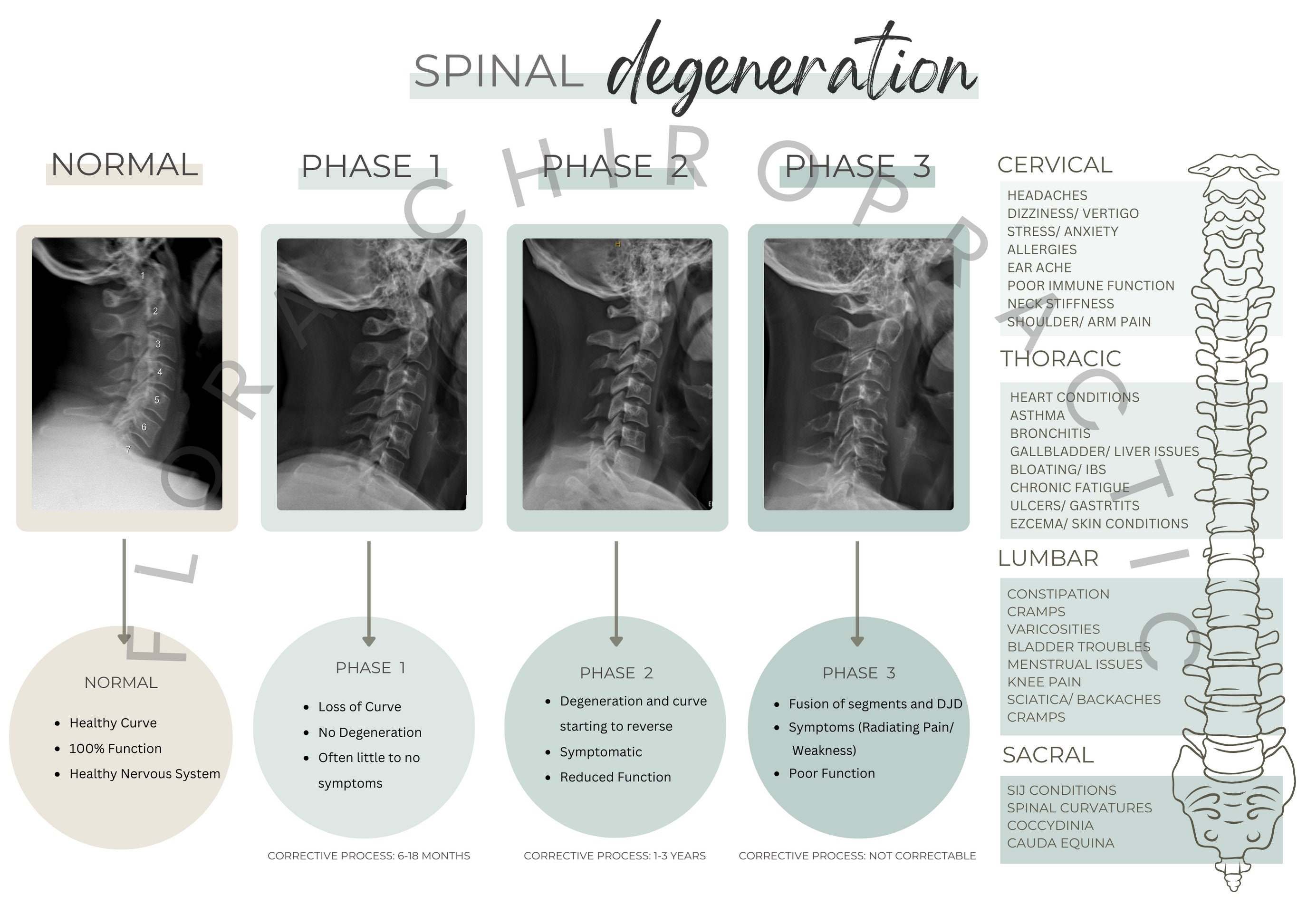 Spinal Degeneration Poster Pdf Download - Etsy