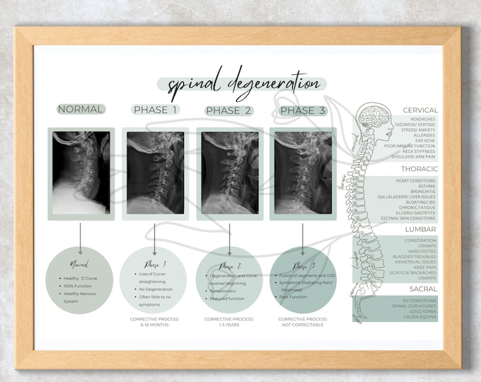 Spinal Nerve and Reflexology Infographic Print by Hearts for Love - Etsy