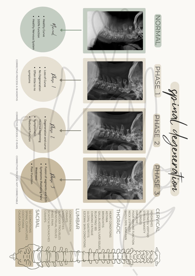 Chiropractic Starter Pack- ROF Pack: 7 Pages Plus Folder Cover Beige ...