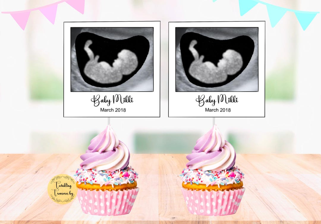 Baby Ultrasound Cupcake Toppers | Baby Shower Cupcake Toppers | Baby ...