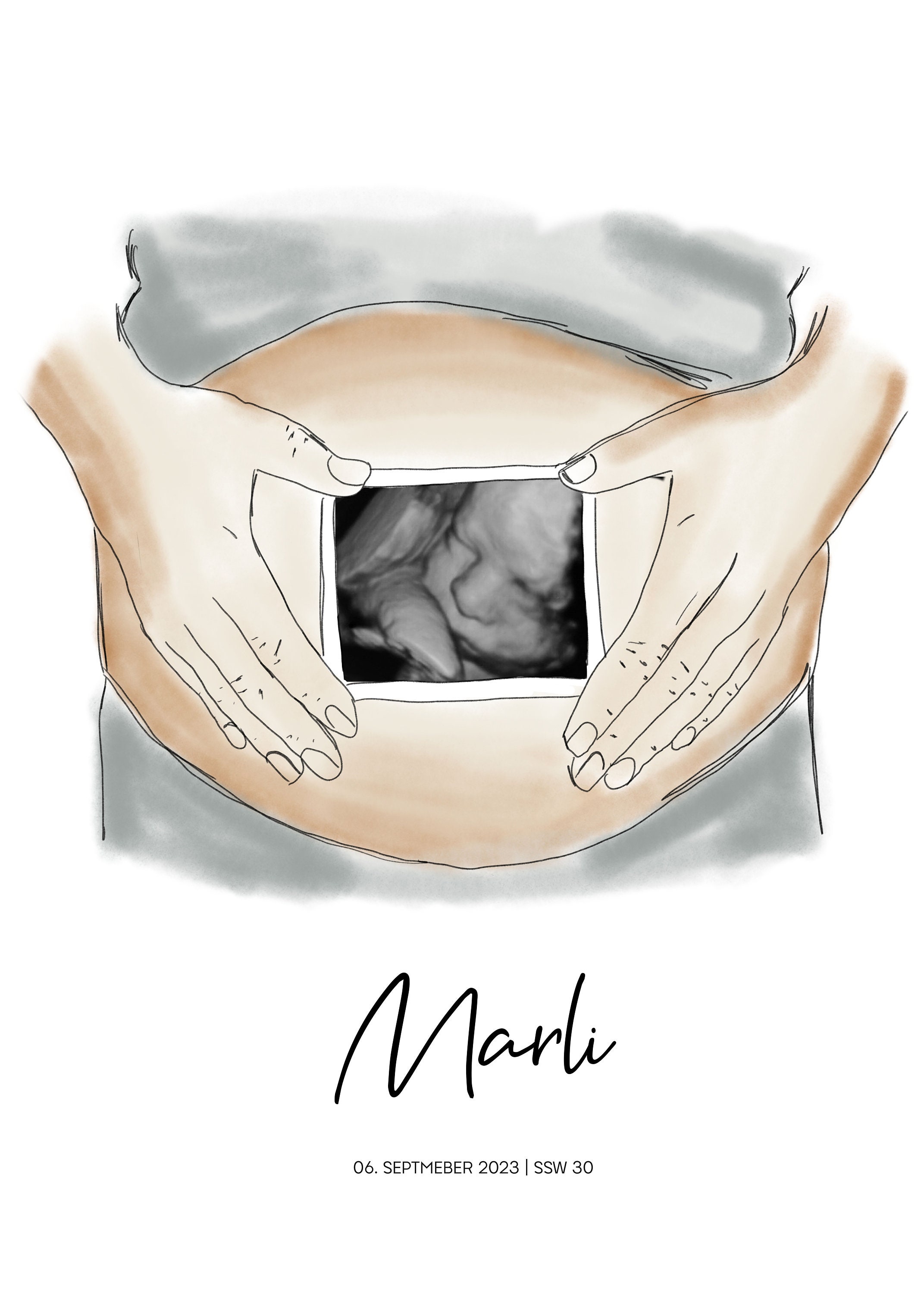 PRINTABLE Ultrasound Poster Echo First Memory for Pregnant - Etsy