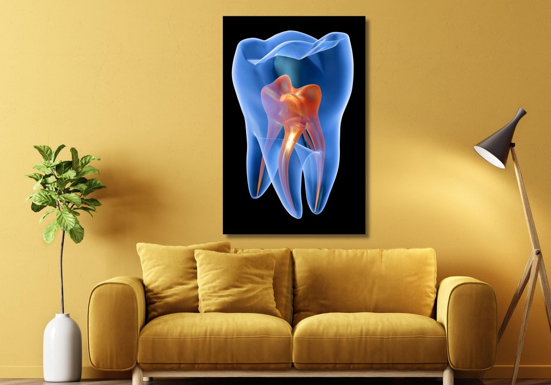 X-ray Molar Tooth Canvas,dentist Office Canvas Wall Art,teeth Wall Art ...