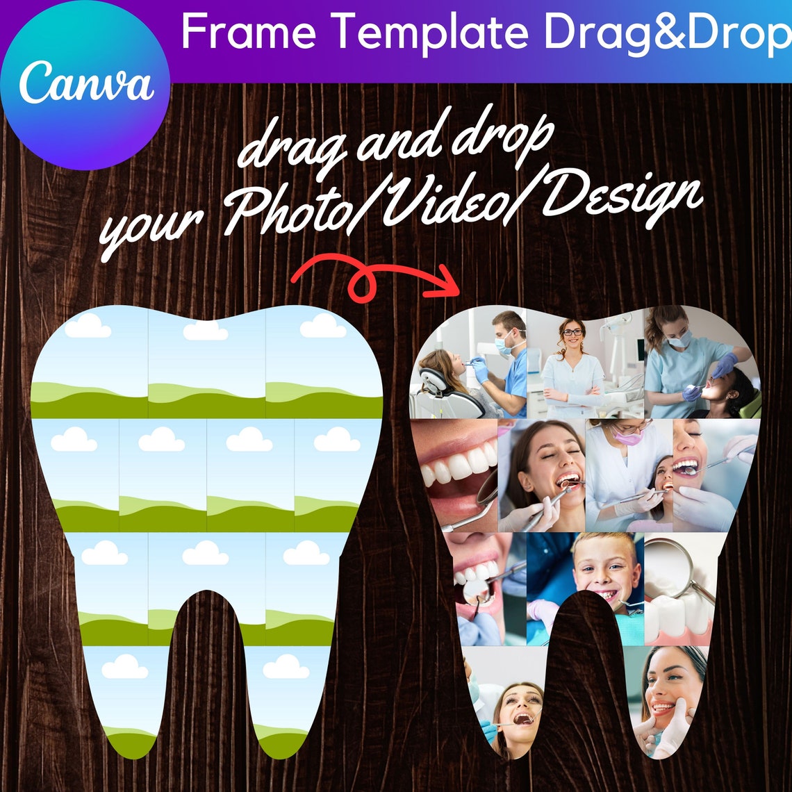 Tooth Collage Canva Frame Template: Dentist Photo Grid (digital ...