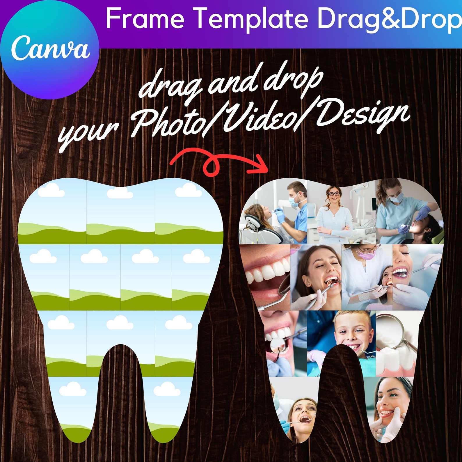 Tooth Collage Canva Frame Template: Dentist Photo Grid (digital ...
