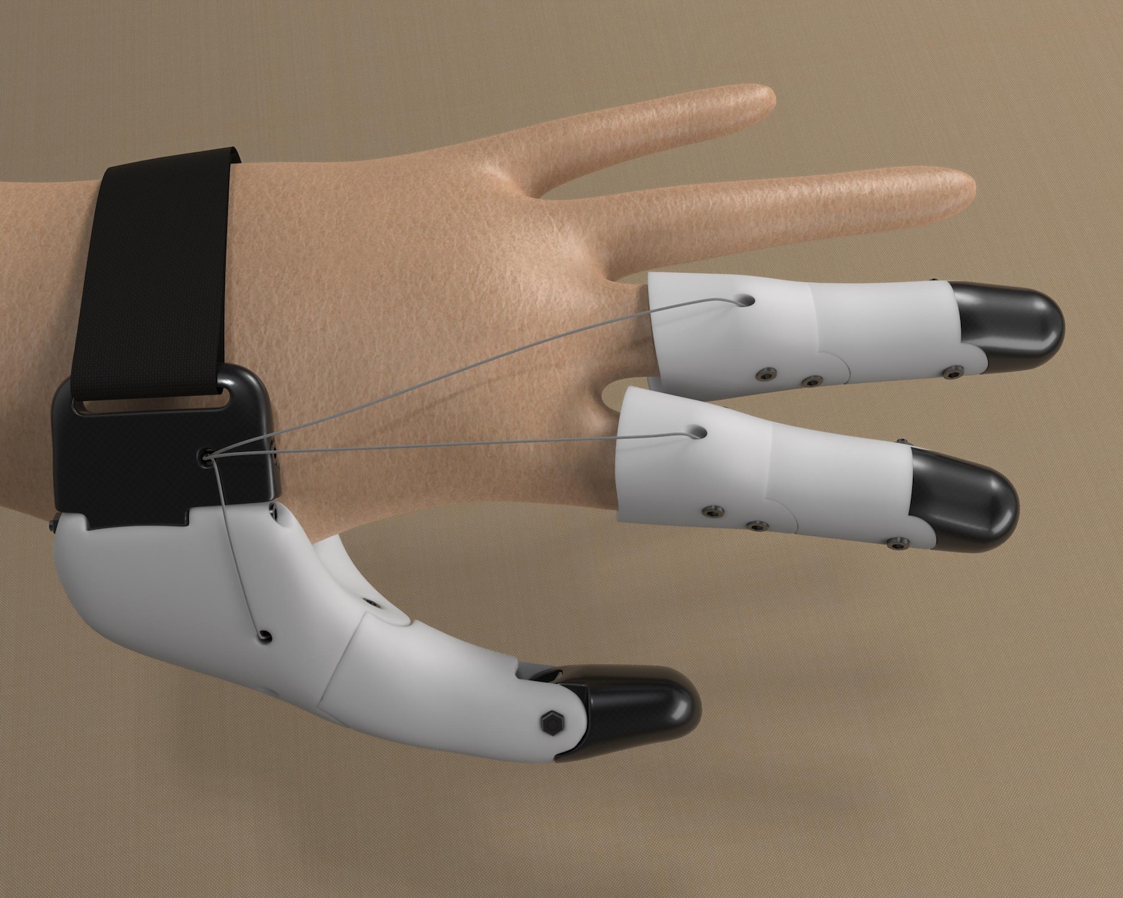 3D Print Full Hand Prosthetic STL File: DIY Finger Replacements ...